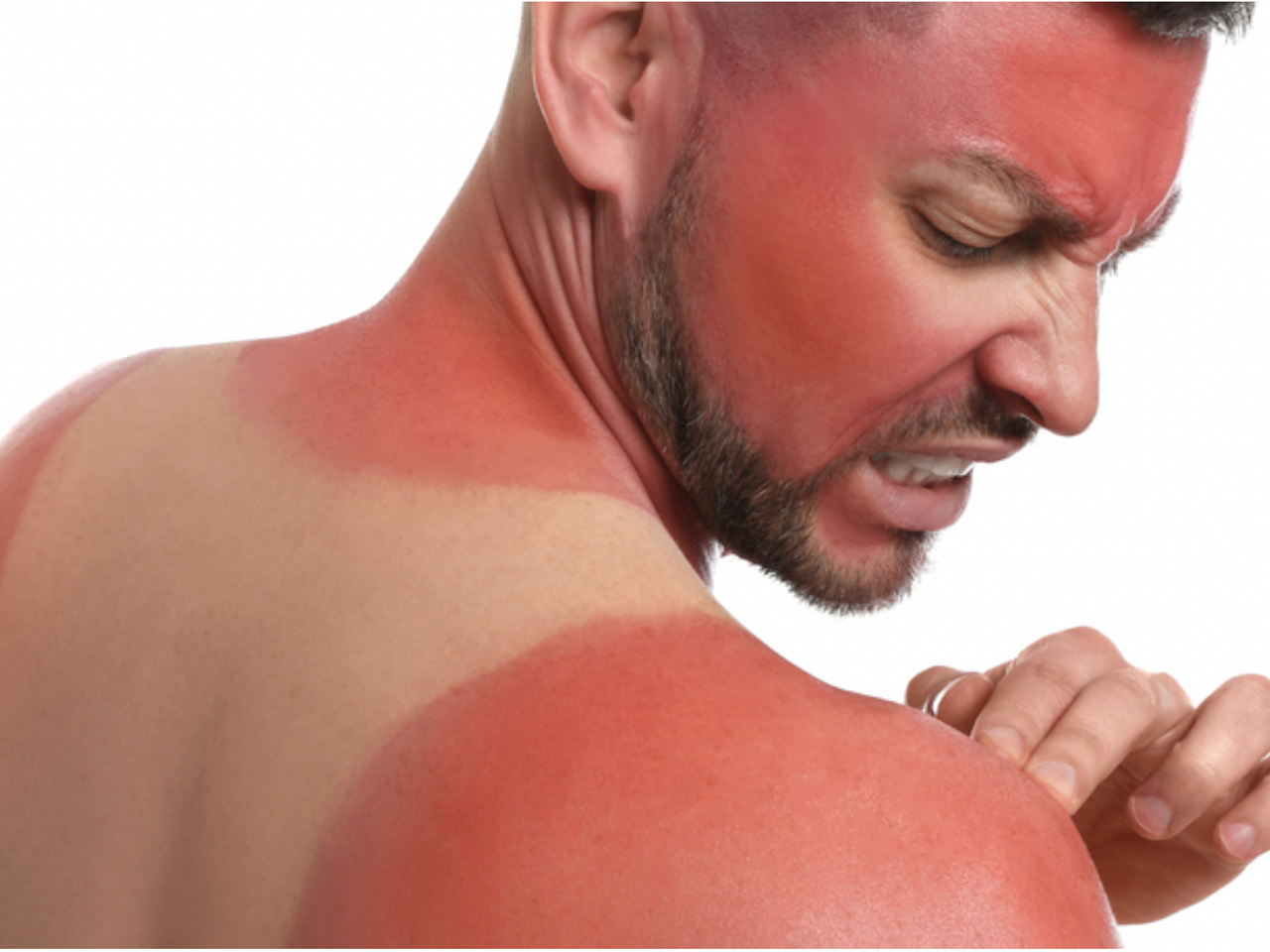 What Are Sun Supplements and How Do They Work? – Soleil Derm